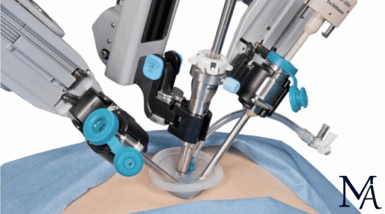 Ablation de la prostate assistée par un robot : video